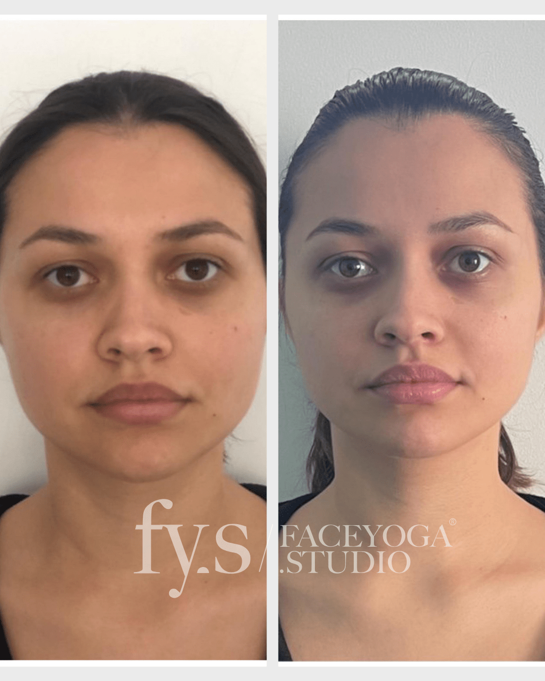 Face Yoga & accessoires : quels outils et techniques privilégier pour ...